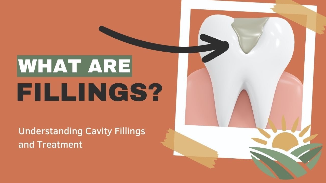 What does filling a cavity do? Understanding Dental Fillings with ...