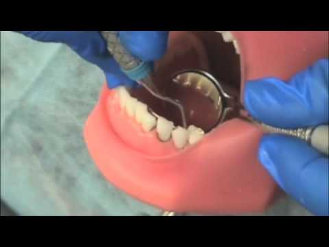 Cross-Arch Fulcrum - YouTube