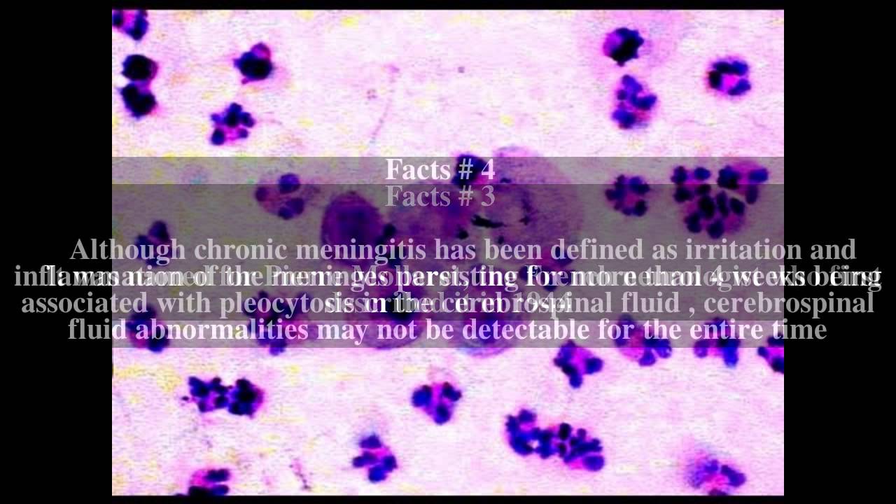 Mollaret's meningitis Top # 6 Facts - YouTube