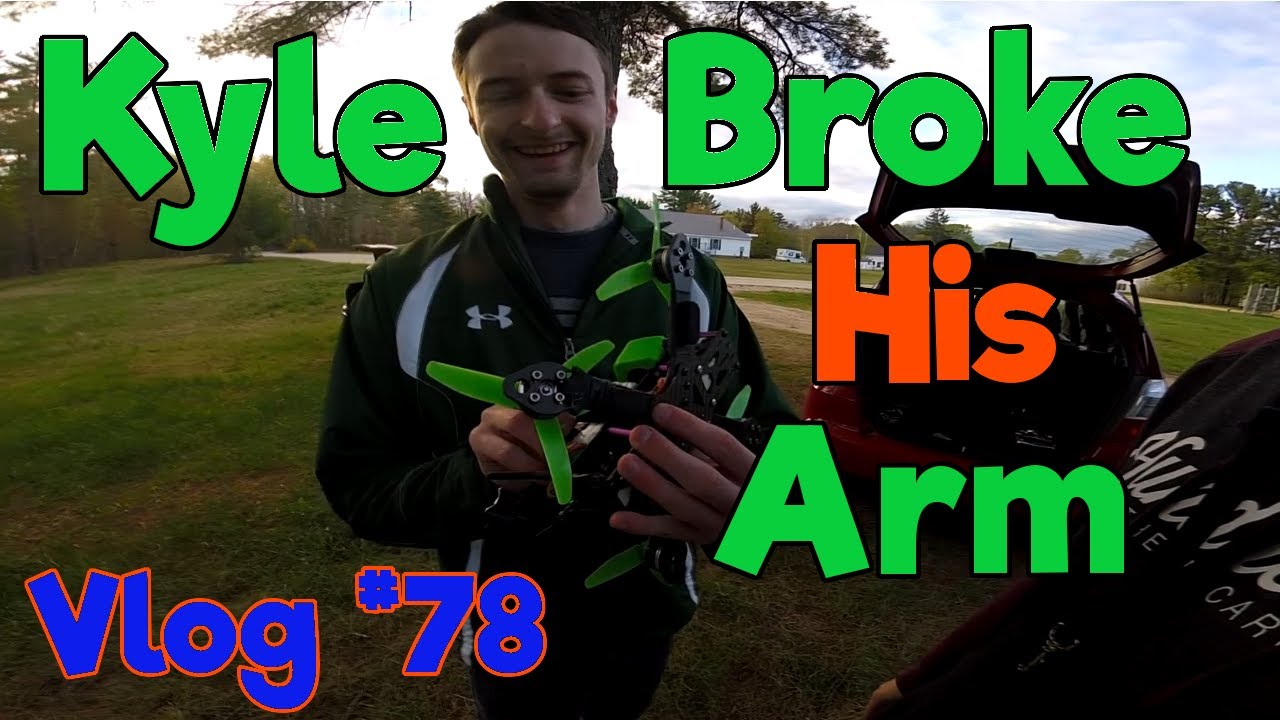 Kyle Broke His Arm - YouTube