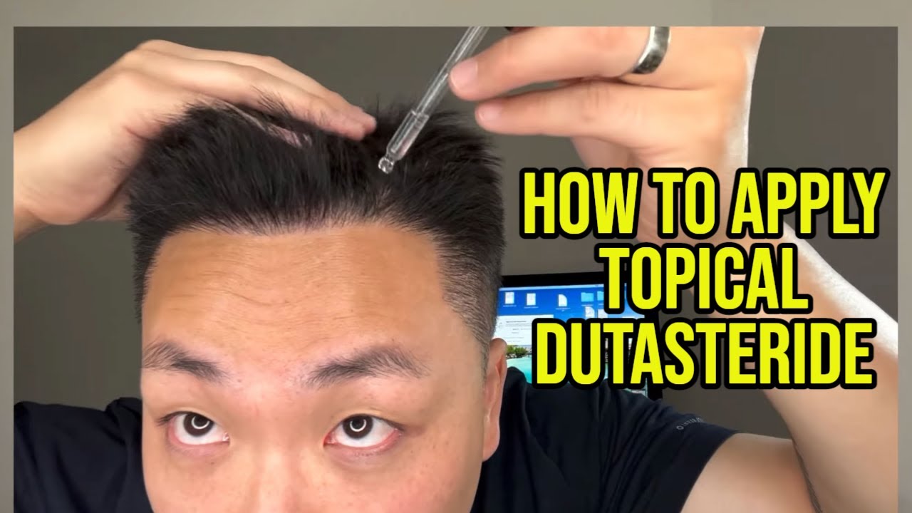 HOW TO APPLY TOPICAL DUTASTERIDE FOR HAIR GROWTH! - YouTube