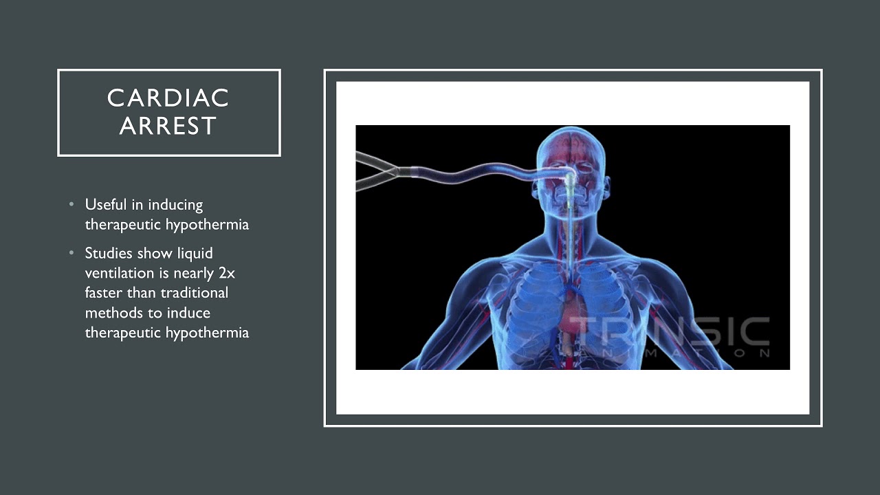 Liquid ventilation presentation - YouTube