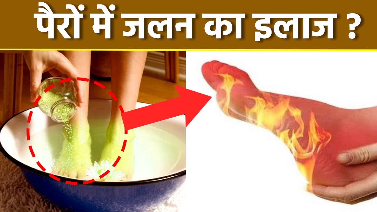 Pairo Me Jalan Ka Ilaj | पैरों में जलन का इलाज | Boldsky - YouTube