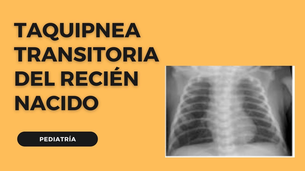Taquipnea transitoria del recién nacido (Síndrome del pulmón mojado ...