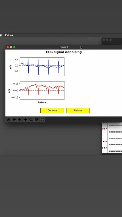ECG signal denoising using Python | Data Processing | Electrophysiology | Electrocardiography ...