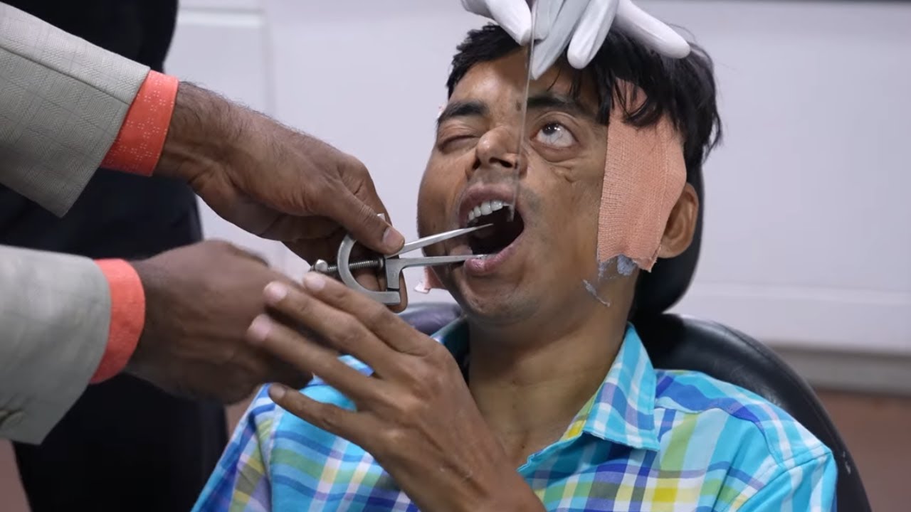 Mouth Opening Surgery Transformation - Beyond Limits - YouTube