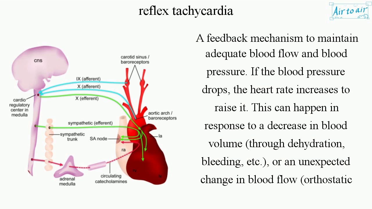 reflex tachycardia - YouTube