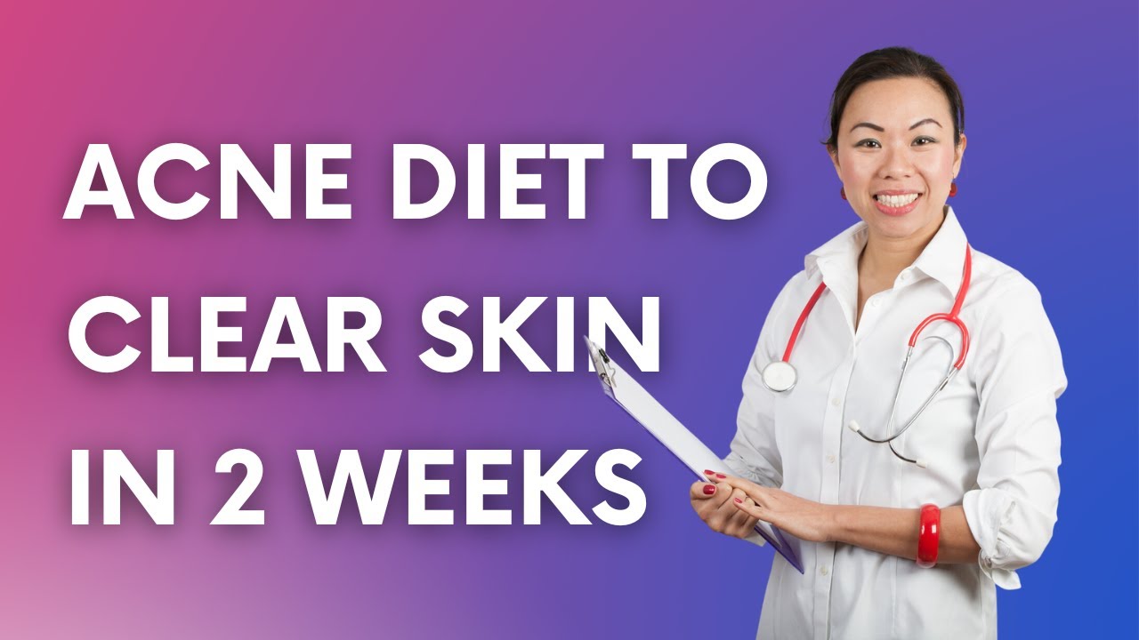 Acne diet to clear skin in 2 weeks without unhealthy restrictions ...