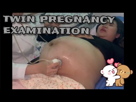 TWIN PREGNANCY BIG BELLY 😘