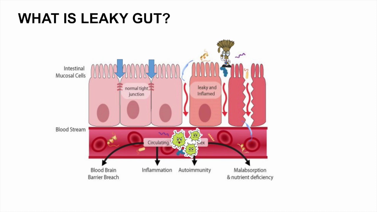 GI UltraMAX Pro Leaky GUT Formula - YouTube
