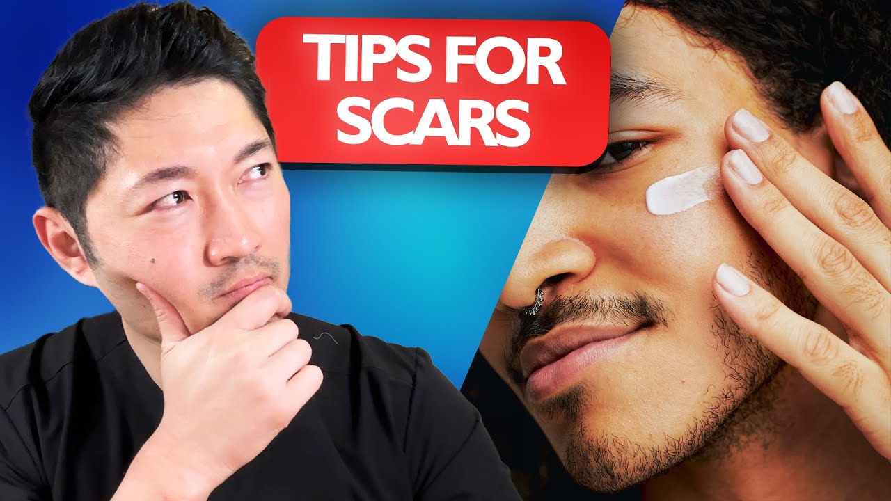 Dermatologist Tips for Preventing Scar - YouTube