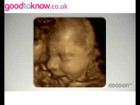 3D/4D baby scan - Anna's Pregnancy Diary: Week 28 - YouTube