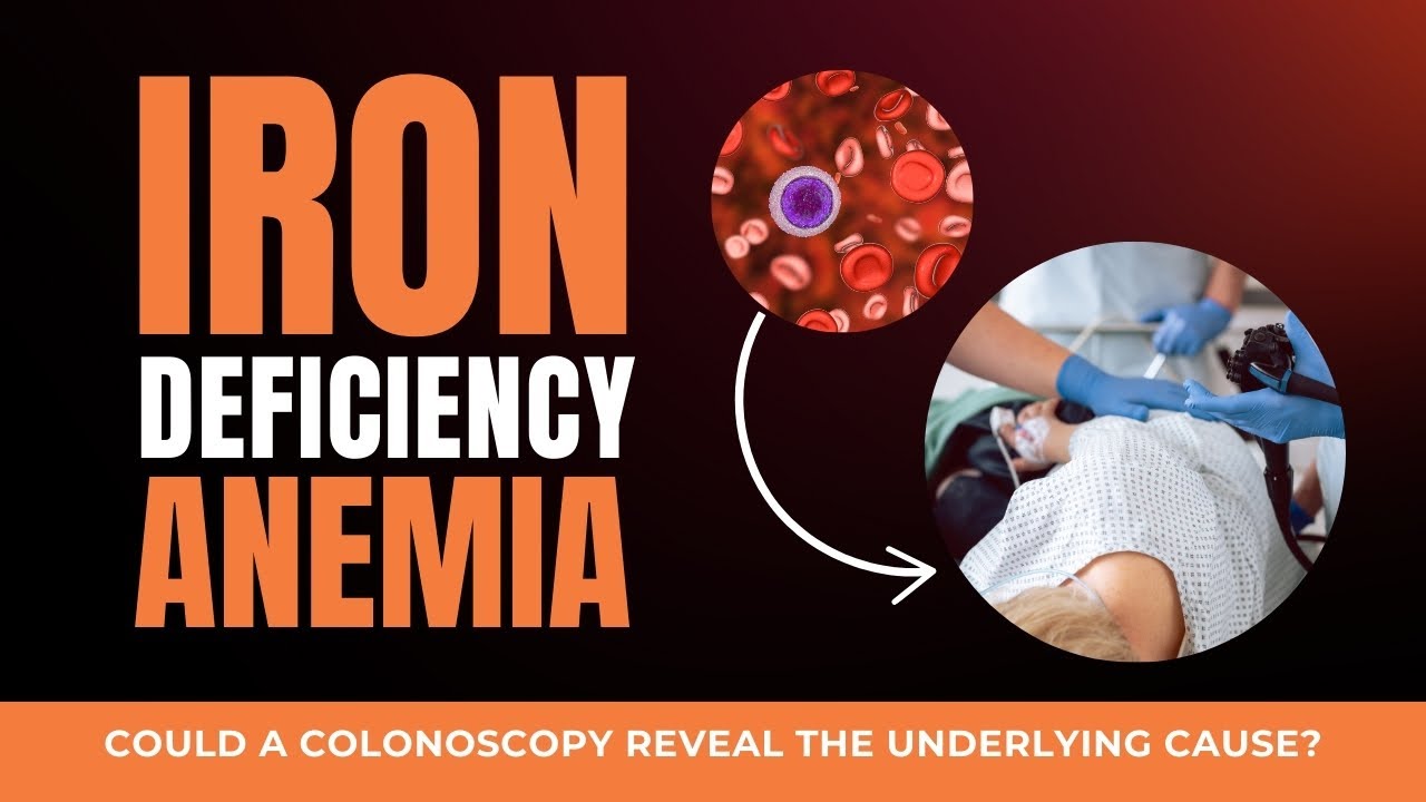 Colonoscopy for Iron Deficiency: Causes, Procedure, and Age Guidelines ...