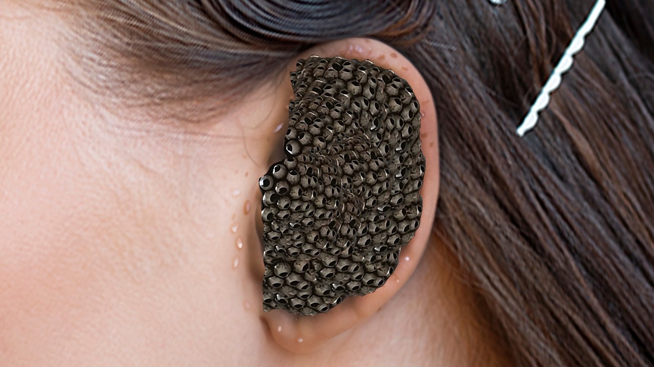 ASMR Ear Treatment Animation Remove Ticks & Maggot Infection | Severely ...