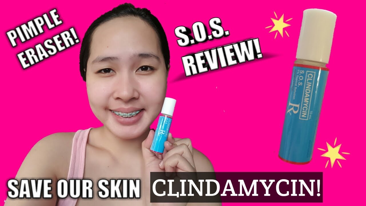 S.O.S REVIEW! | SAVE OUR SKIN CLINDAMYCIN | PIMPLE ERASER | ACNE ...