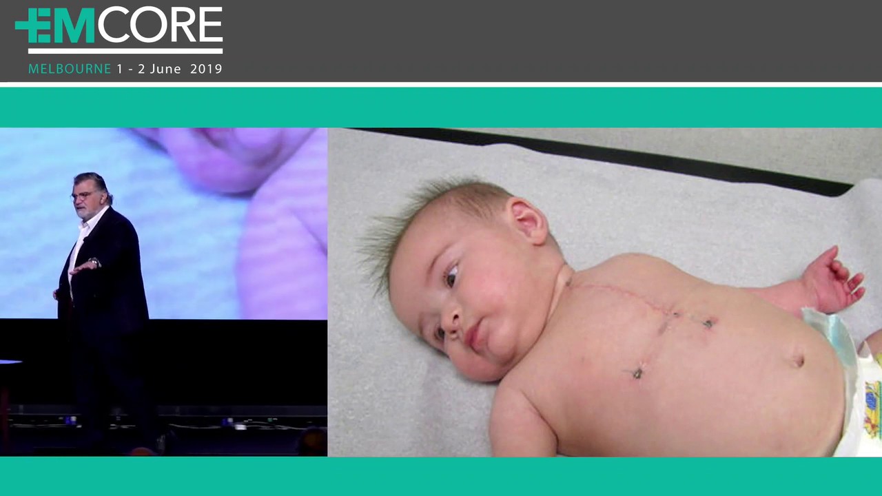 Syncope in children - YouTube