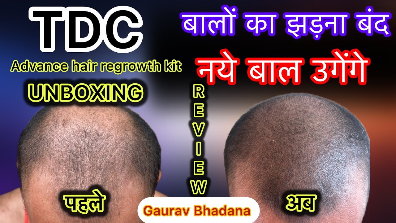 Tdc advance hair growth kit review || unboxing || how to use tdc ...