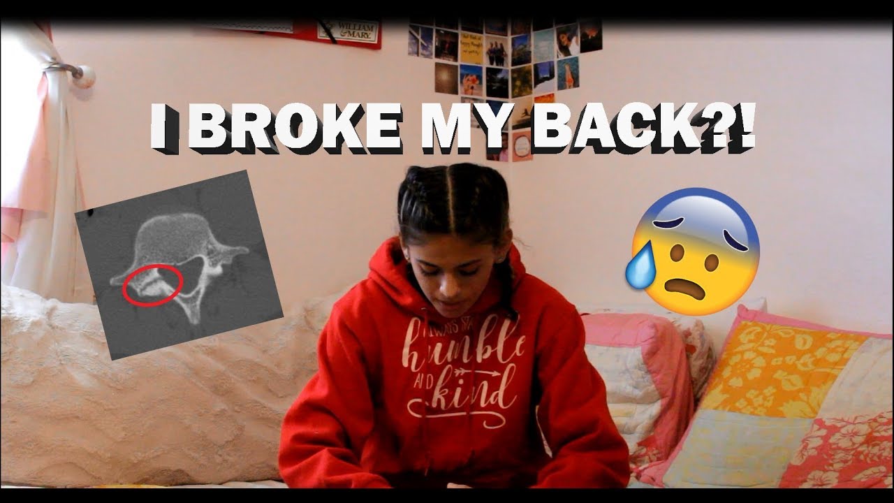 HOW I BROKE MY BACK! + MOTIVATION FOR INJURIES - YouTube