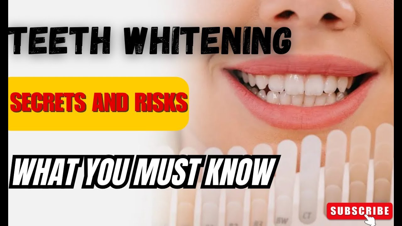 Teeth Whitening Secrets and Risks: What You Must Know - YouTube