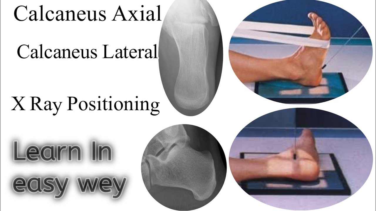 Calcaneus axial & Lateral positioning | Calcaneus Axial view | Learn in ...