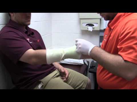 Short Arm Cast with Thumb Spica - YouTube