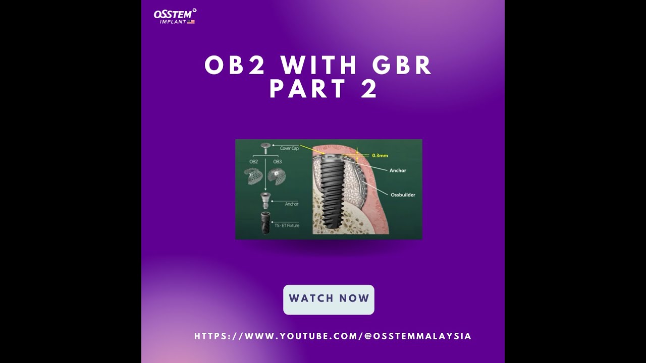 [Master Course - SURGERY] OB2 with GBR Part 2 - YouTube