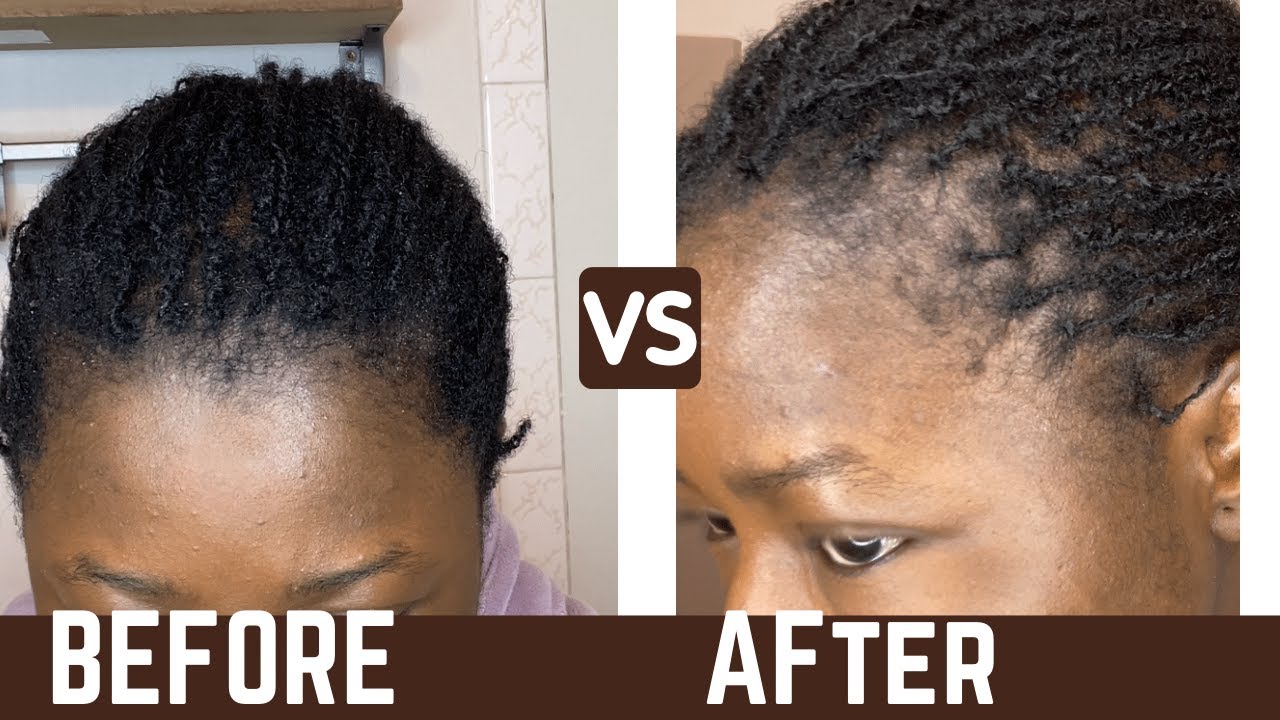 HOW I INTERLOCK MY THIN, SHORT, AND DAMAGED EDGES USING CROCHET NEEDLE ...