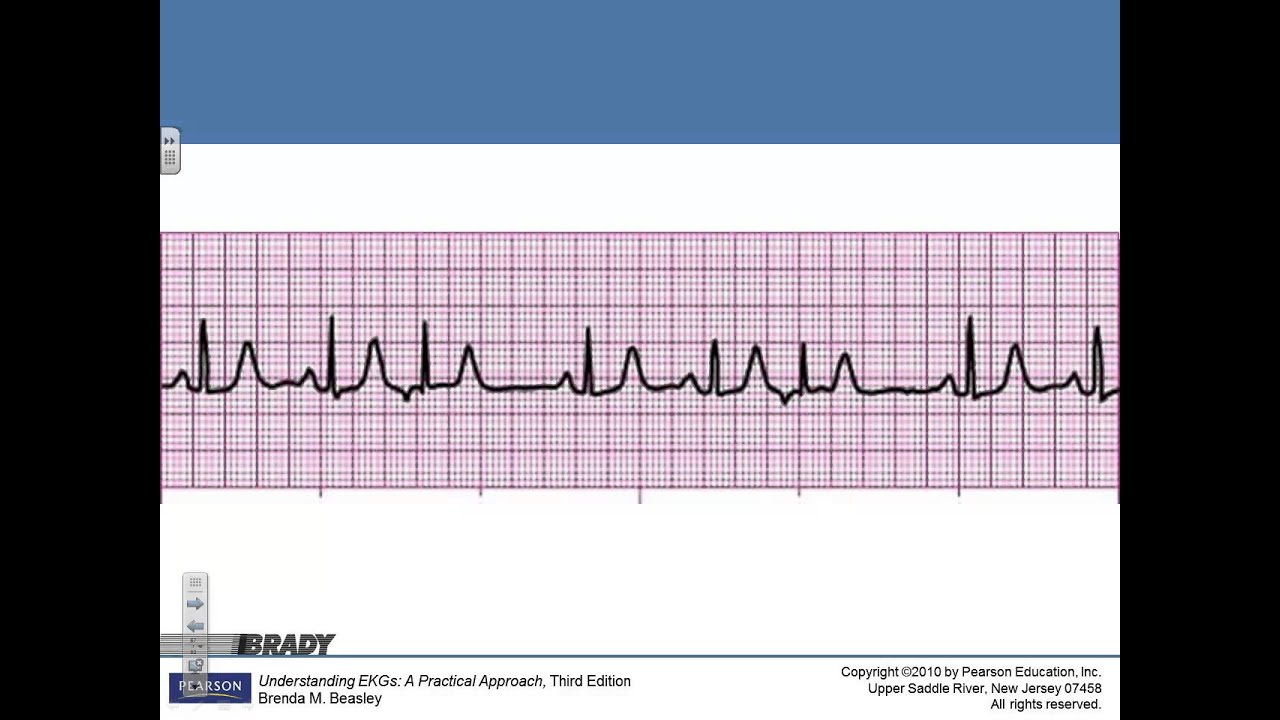 Ch 11 - practice strips - YouTube