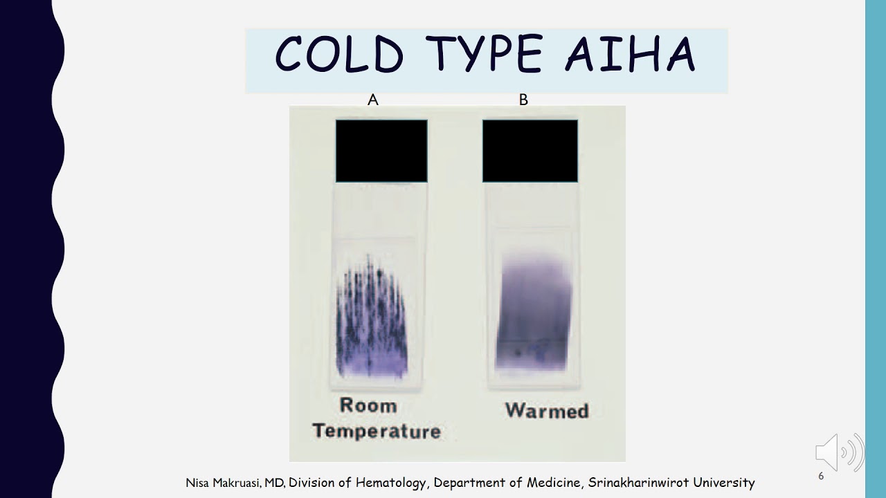 การอ่านสไลด์ blood smear ตอนที่ 1 (How to read a blood smear ...