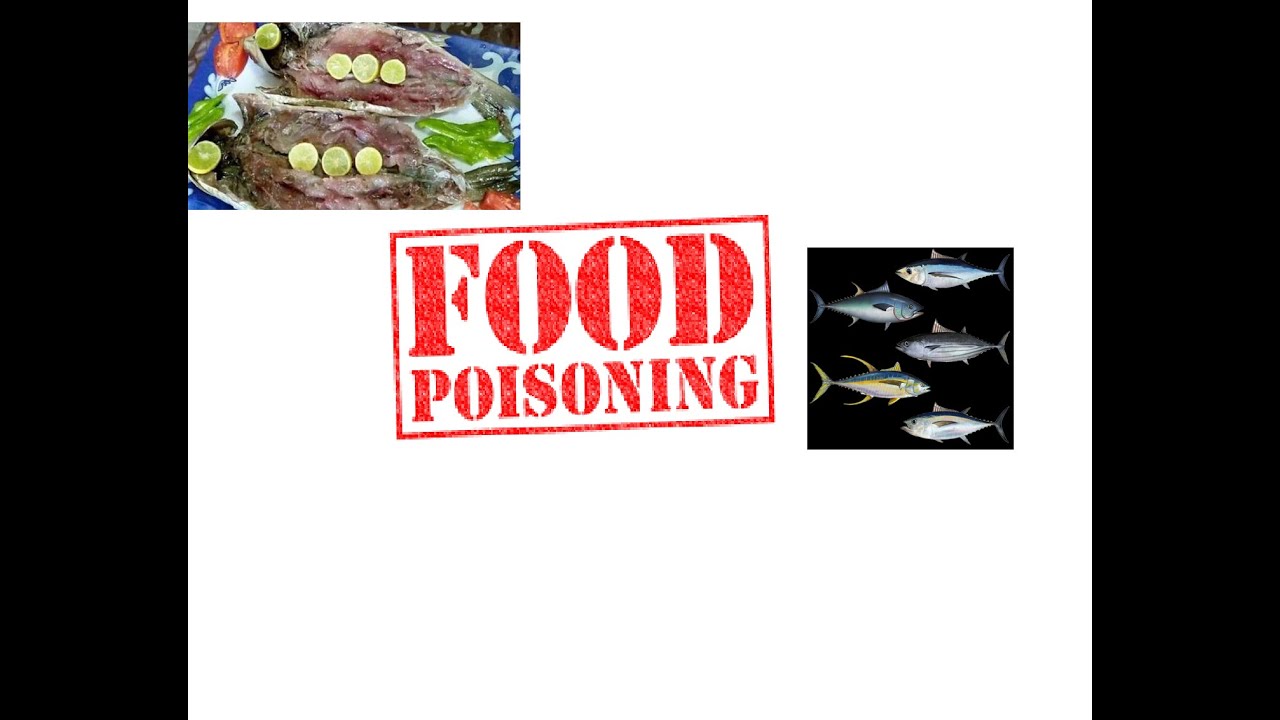 Food poisoning - ciguatera- scombroid- botulism - YouTube