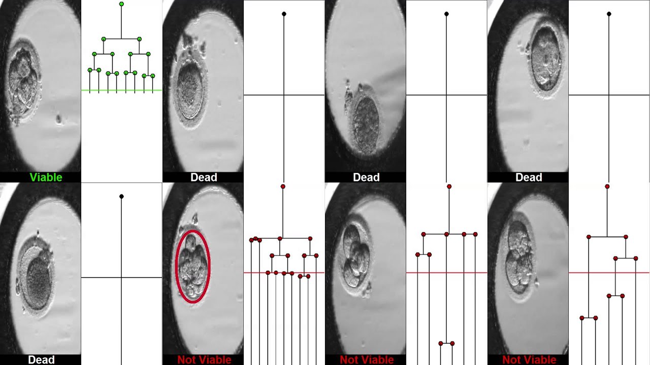 Visualizing time-lapsed lineage trees of human embryos - YouTube