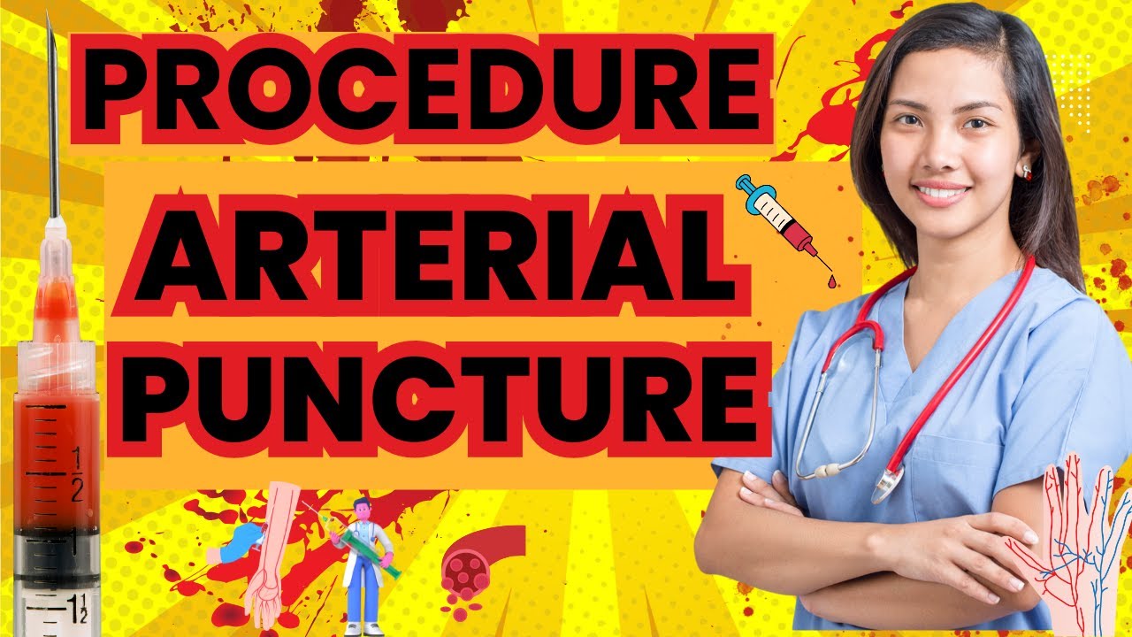 Arterial puncture technique preparation & procedure | 4K | CRITICAL ...