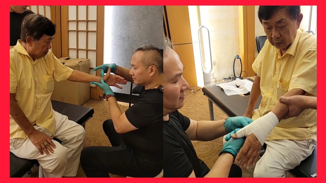 Chris Leong Treatment DeQuervain Mama Hand Problems😱 - YouTube