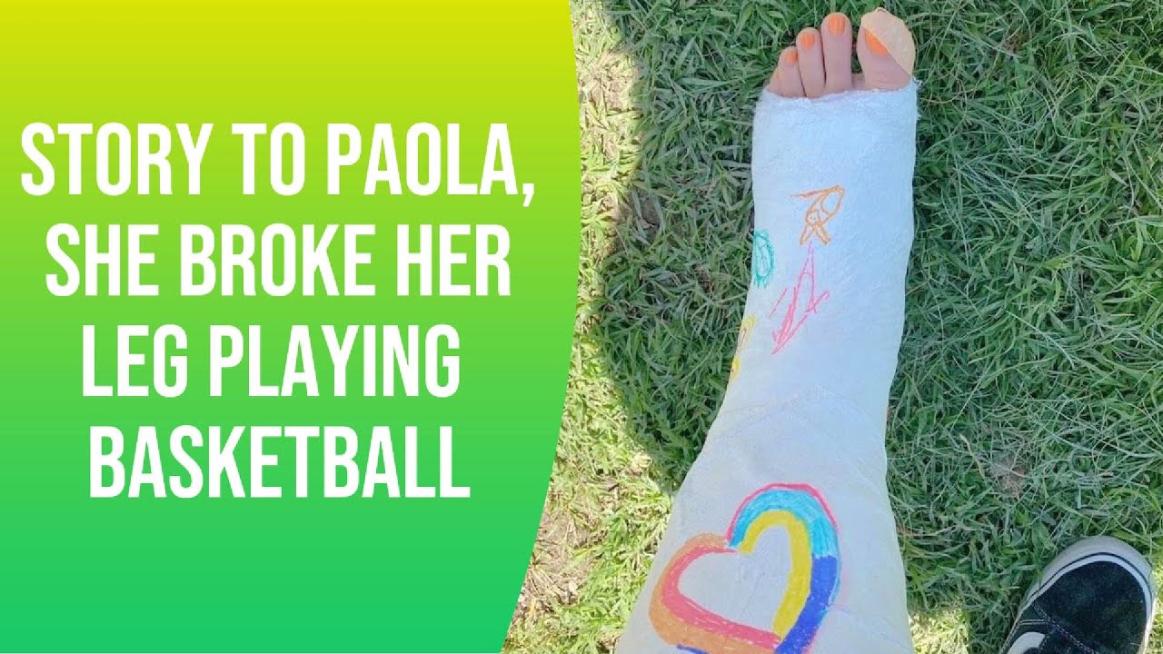 Paola and her plaster leg cast SLC - YouTube
