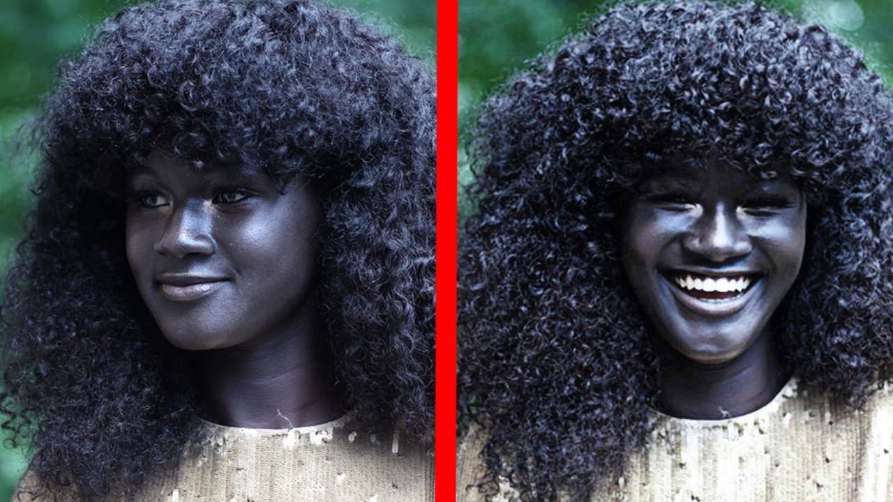 5 Menschen - Mit Einer Einzigartigen Hautfarbe! - YouTube