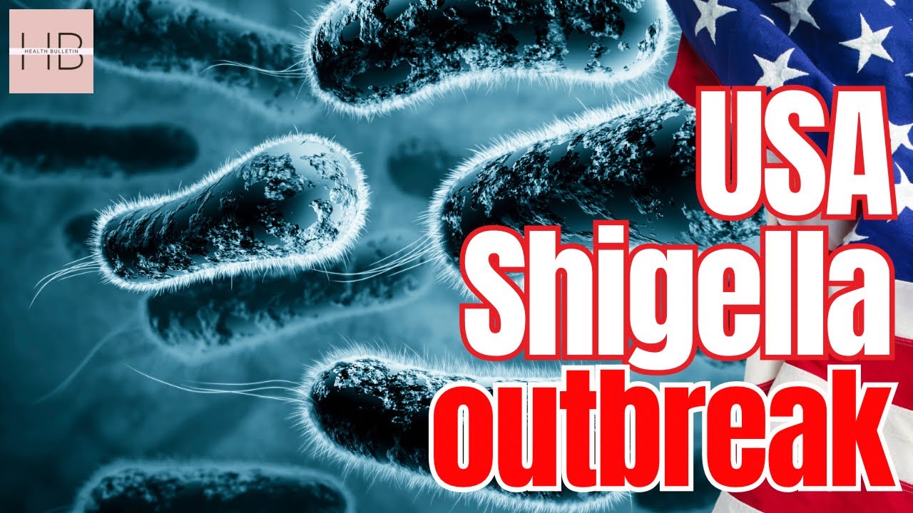 Shigellosis Outbreak in US Changes Everything for the Homeless ...