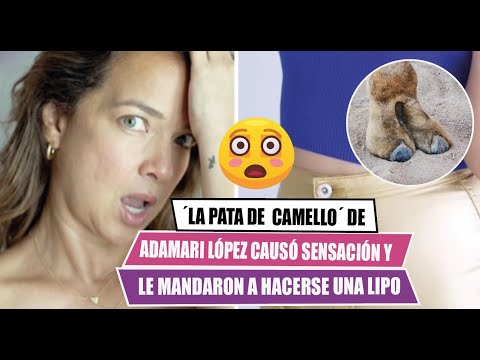 🚩¨La pata de camello¨ de ADAMARI LÓPEZ😱 causó sensación y le mandaron hacerse una lipo 😲