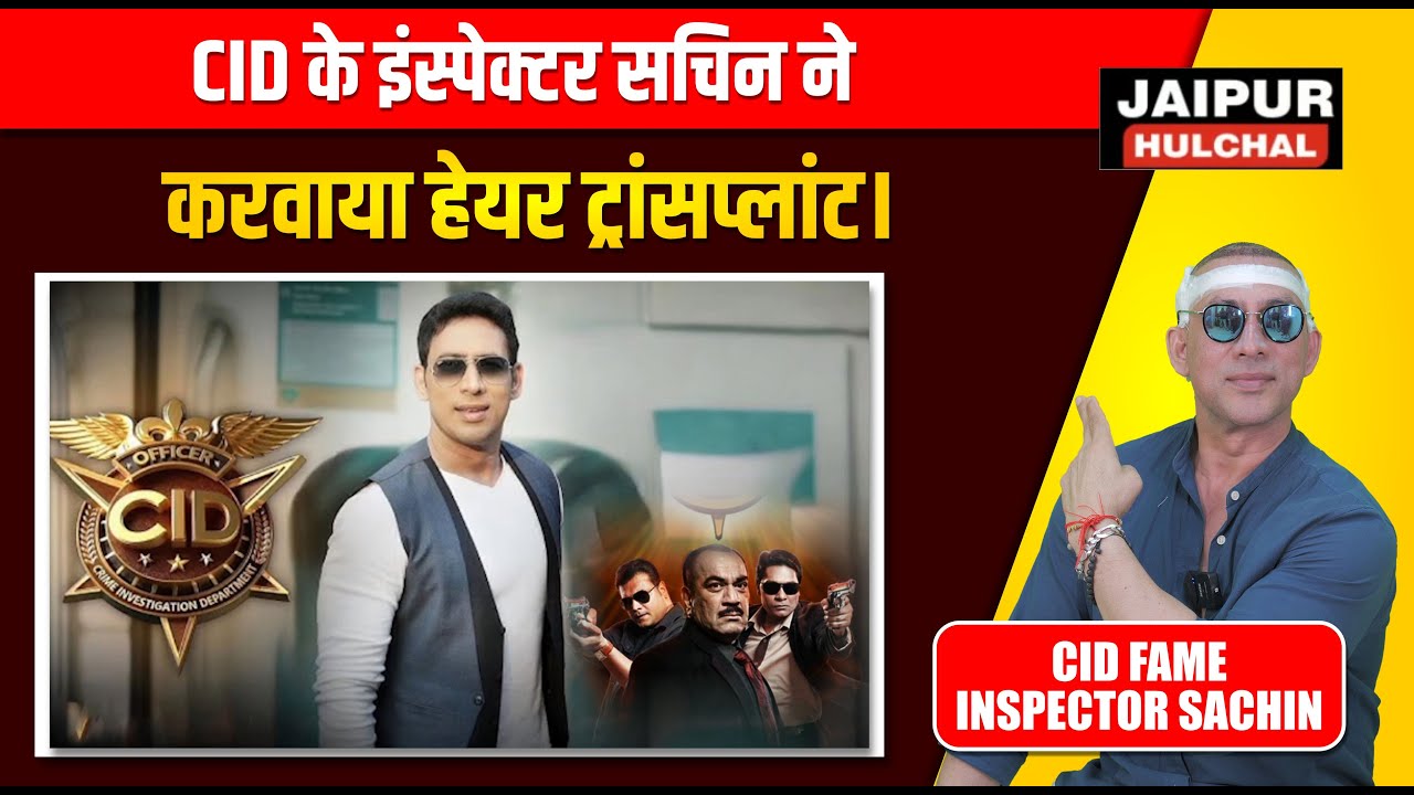 CID inspector Sachin did Hair Transplant from IFT Hair Science in ...