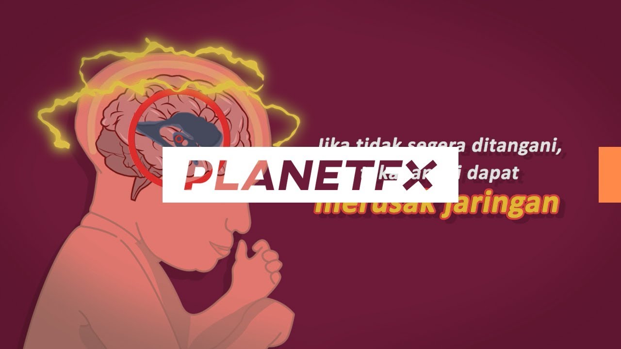 Motion Graphic Animation HYDROCEPHALUS "SNei" - By PLANET FX - YouTube