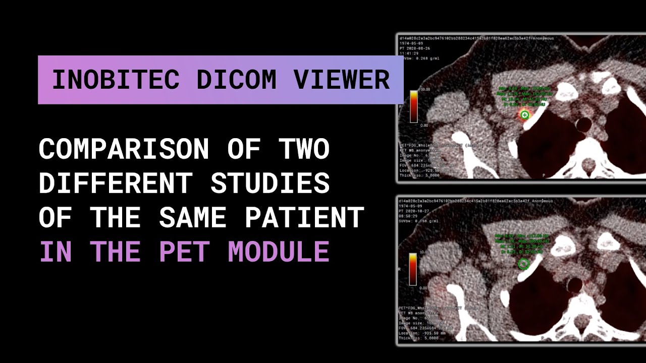 Comparison of two different studies of the same patient in the PET ...