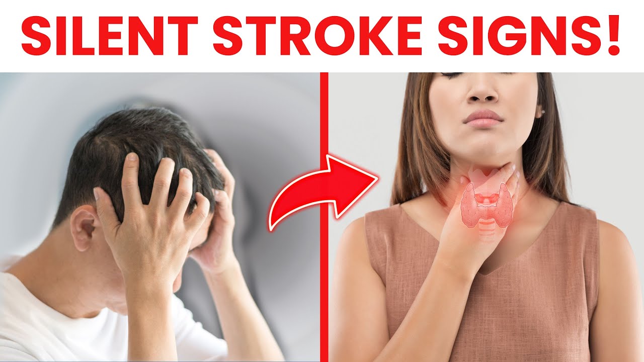 8 Signs of Silent Strokes You Can't Ignore - YouTube