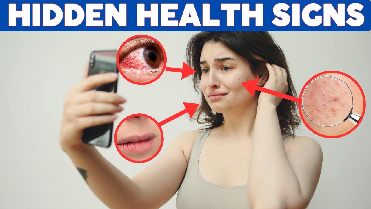 8 Shocking Ways Your Face Exposes Serious Health Issues - YouTube