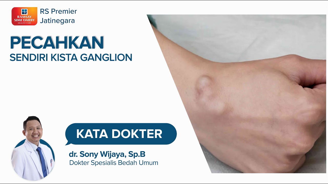 YUK OBATI BENJOLAN DI SENDI ATAU TENDON (KISTA GANGLION) - KATA DOKTER ...