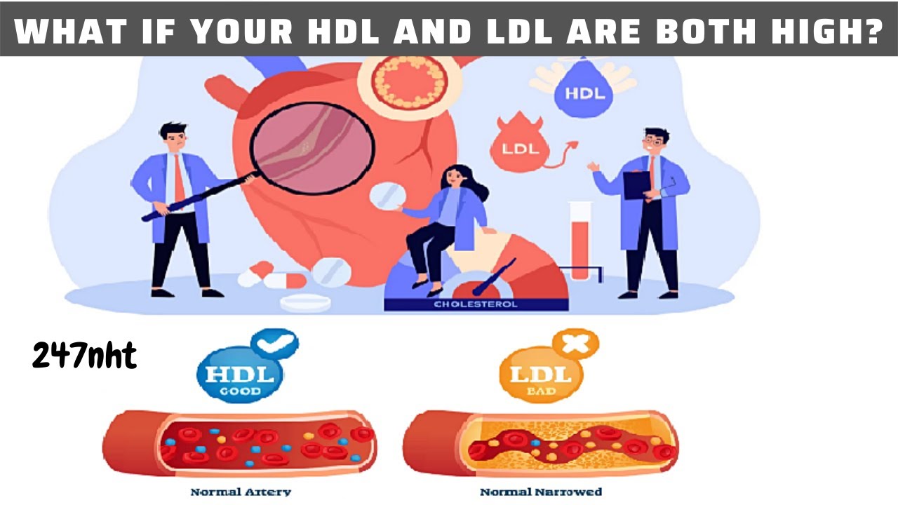 Hdl And Ldl Cholesterol What Are Good Ldl And Hdl Levels Does High