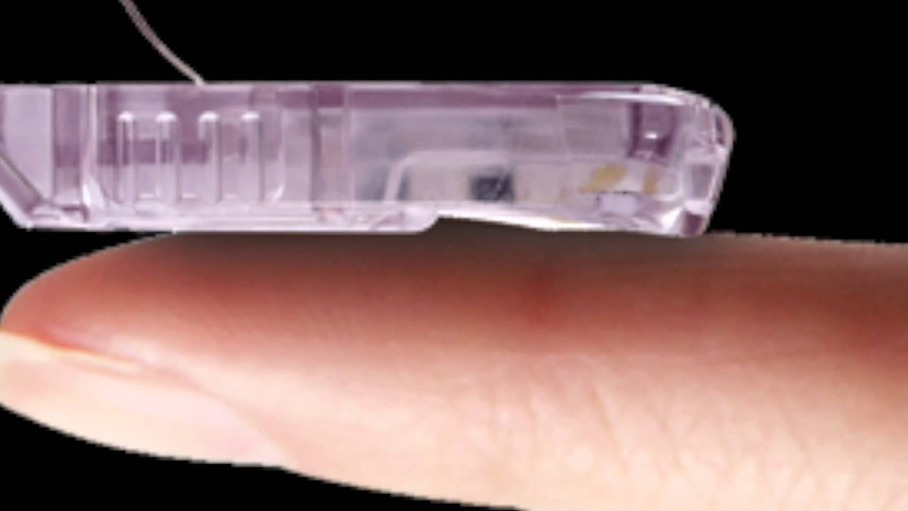 The Future of Diabetes Technology - YouTube