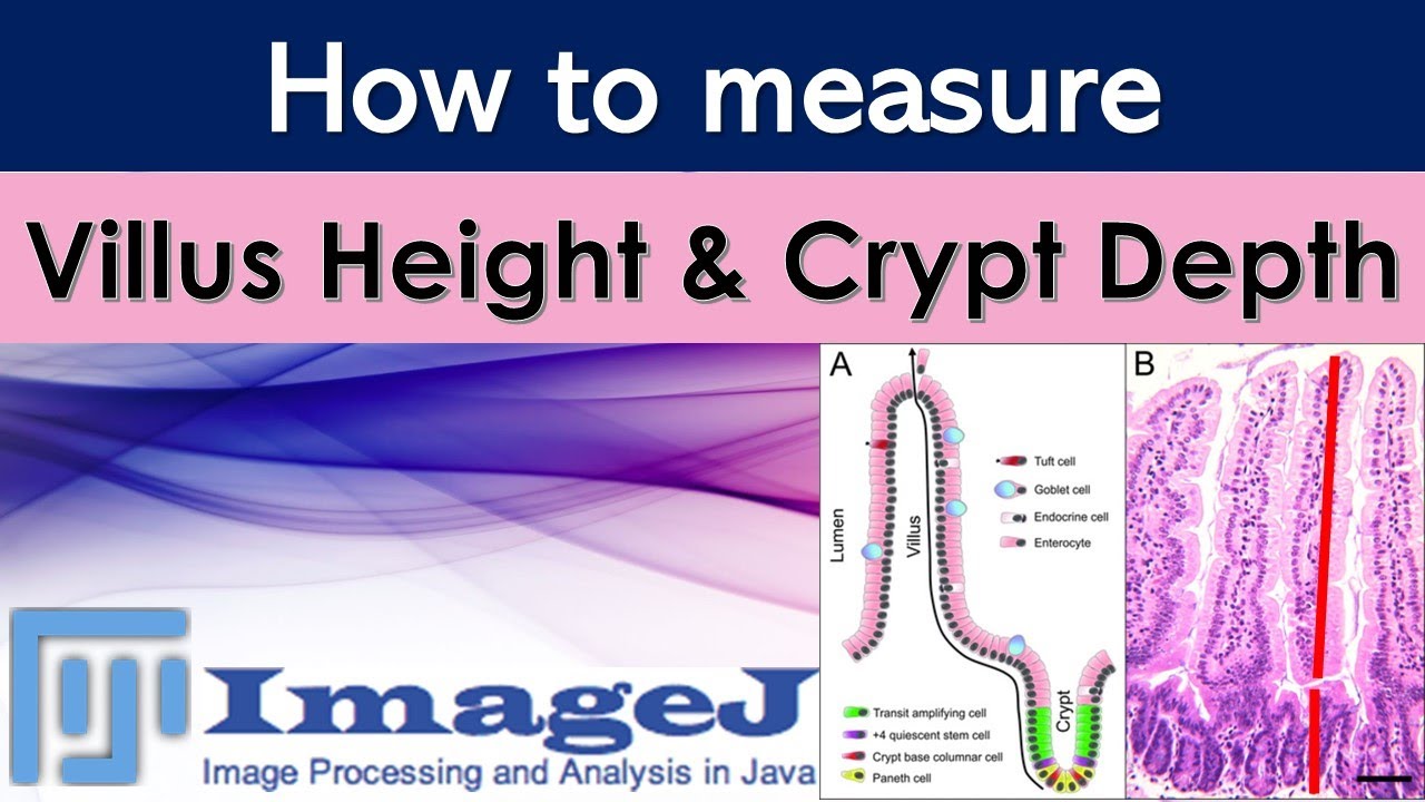 Measurement of villus height and crypt depth with ImageJ | Morphometry ...