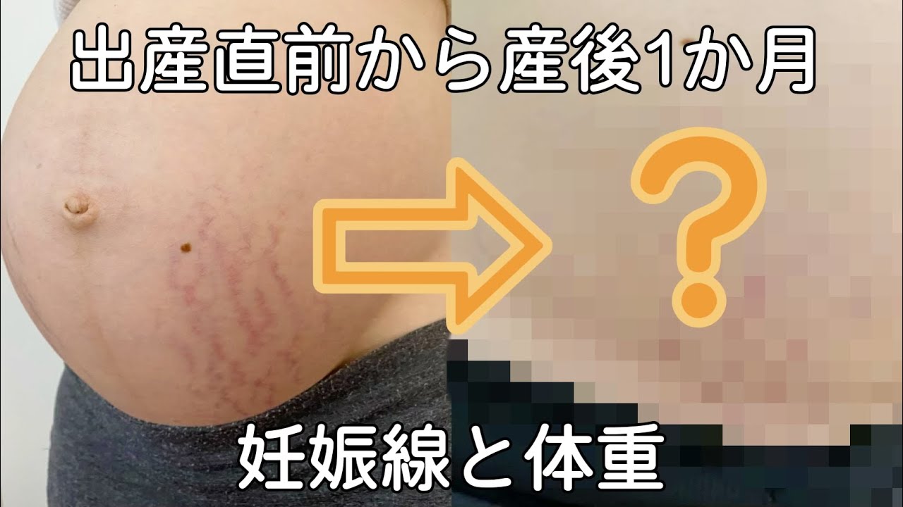 出産直前から産後1か月の妊娠線と体重の変化 産後ダイエットなし Youtube