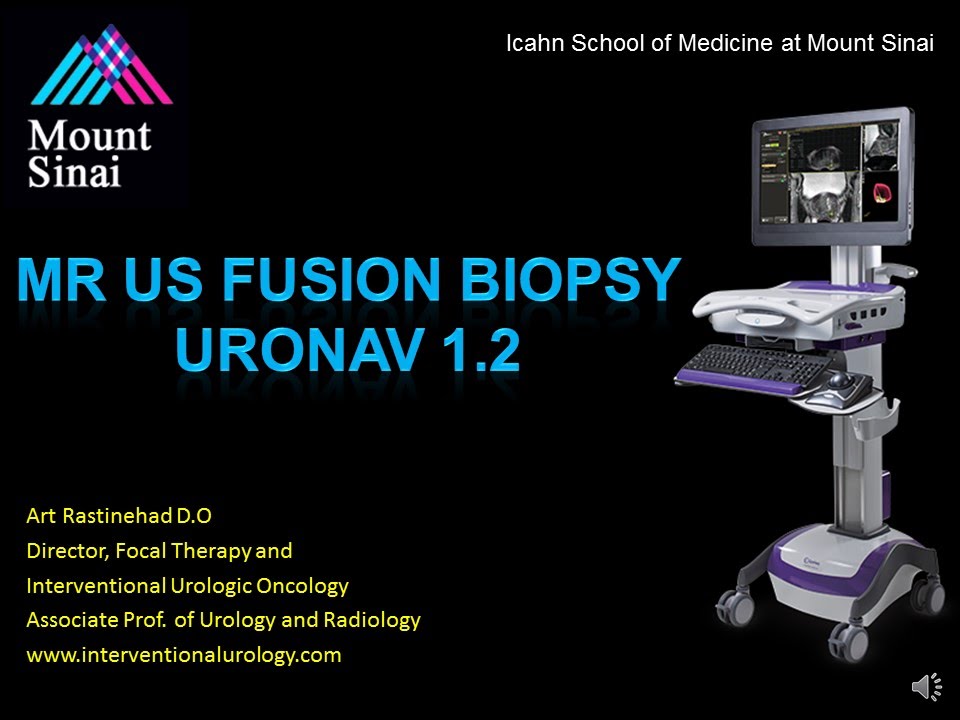 7. UroNav Fusion Biopsy Version 1.2 - NEW Software Release Feb 2016 ...