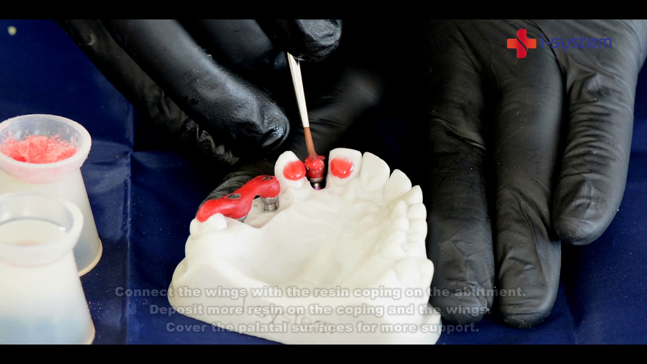 I-system Verification Jig: Single Restoration - YouTube