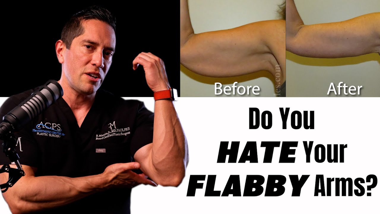 Don't Like Your FLABBY ARMS???? Here's How You Can Fix It! - Dr ...